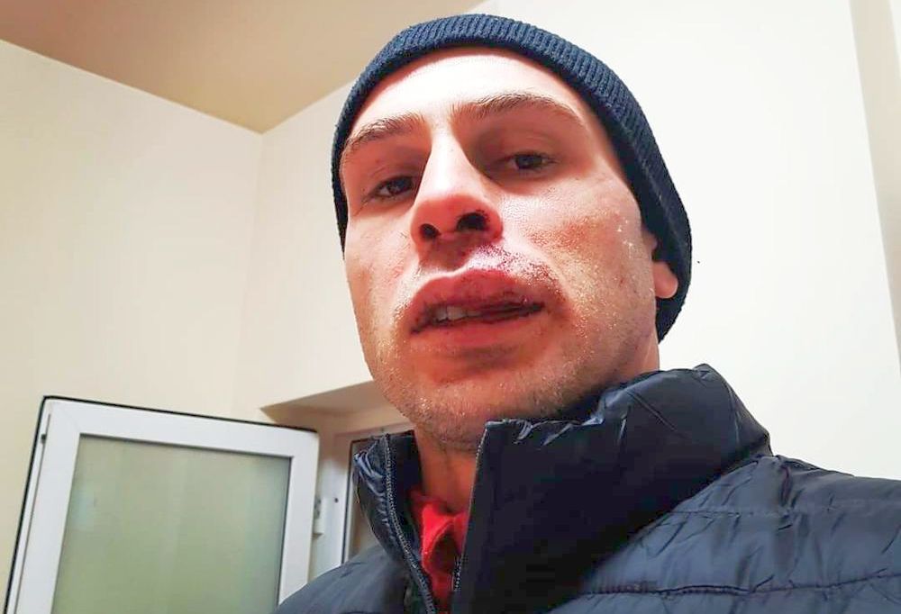 Primele declarații ale lui Slavko Perovic, după accidentarea horror din ...