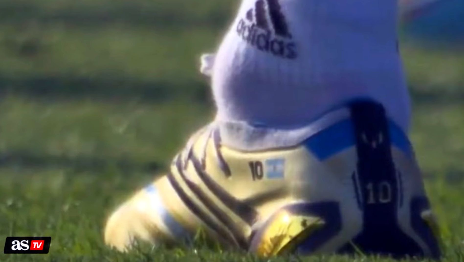 Imagine șocantă cu glezna umflată a lui Leo Messi de la World Cup 2022